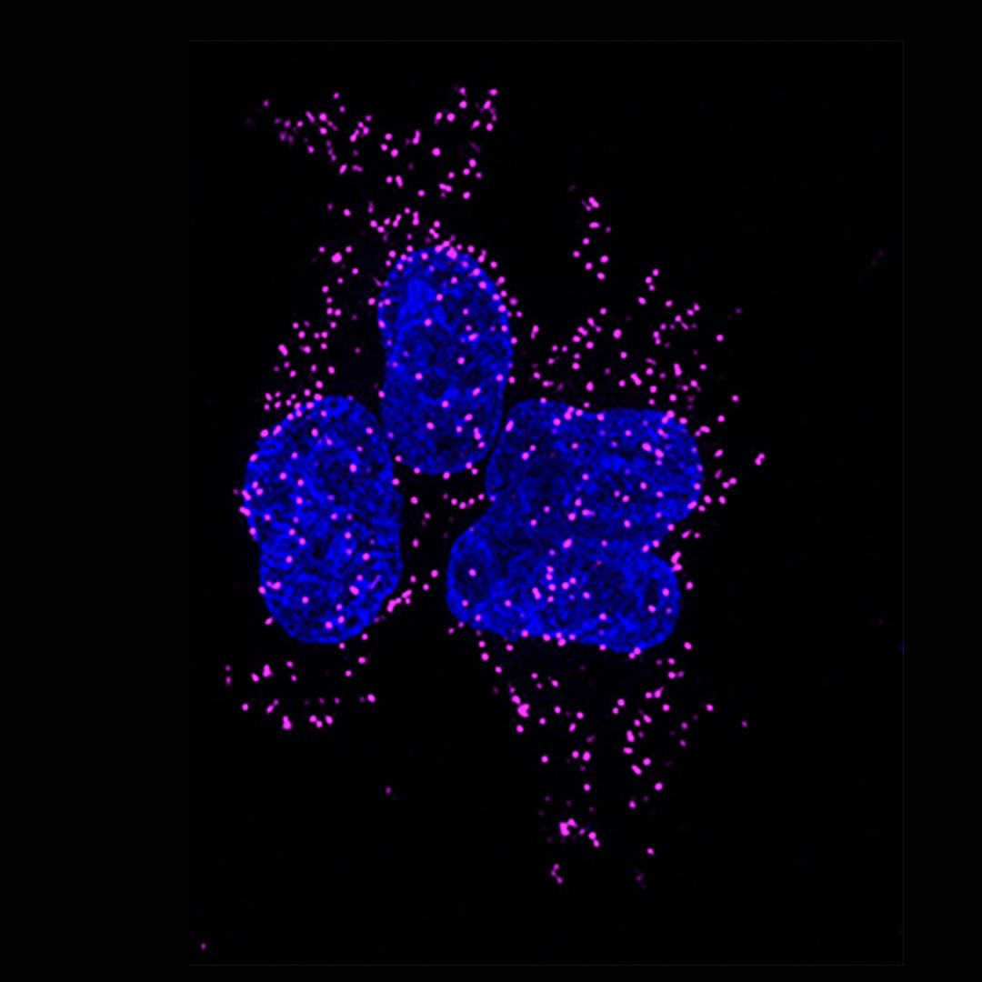 Descubierto un nuevo mecanismo molecular esencial para la adaptación celular al estrés | IRB ...